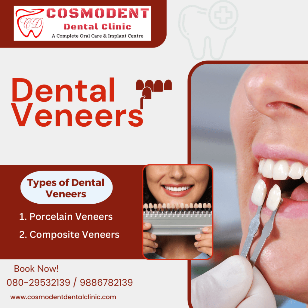 Why You Need Dental Veneers? Benefits & Procedure Explained