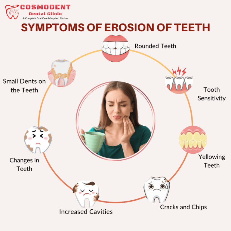 Erosion of teeth: Causes, symptoms & prevention